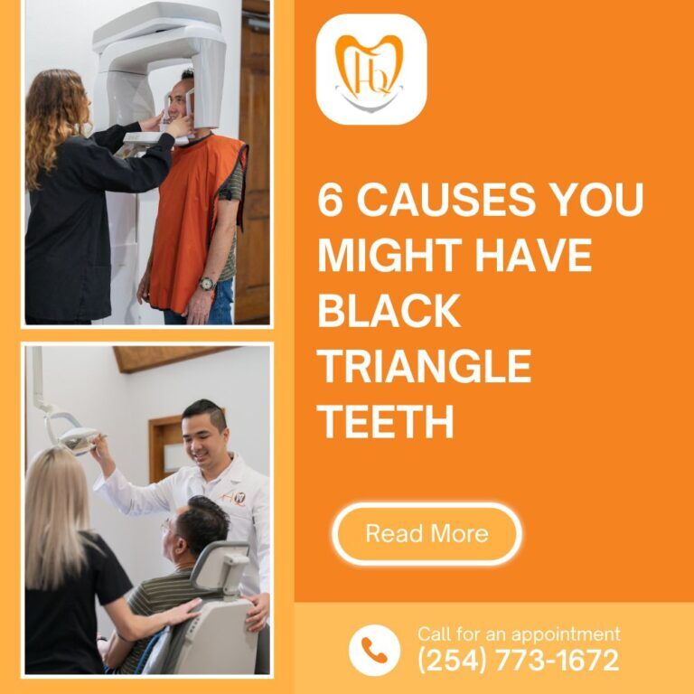 6 Proven Causes of Black Triangle Teeth | HQ Temple Dentist