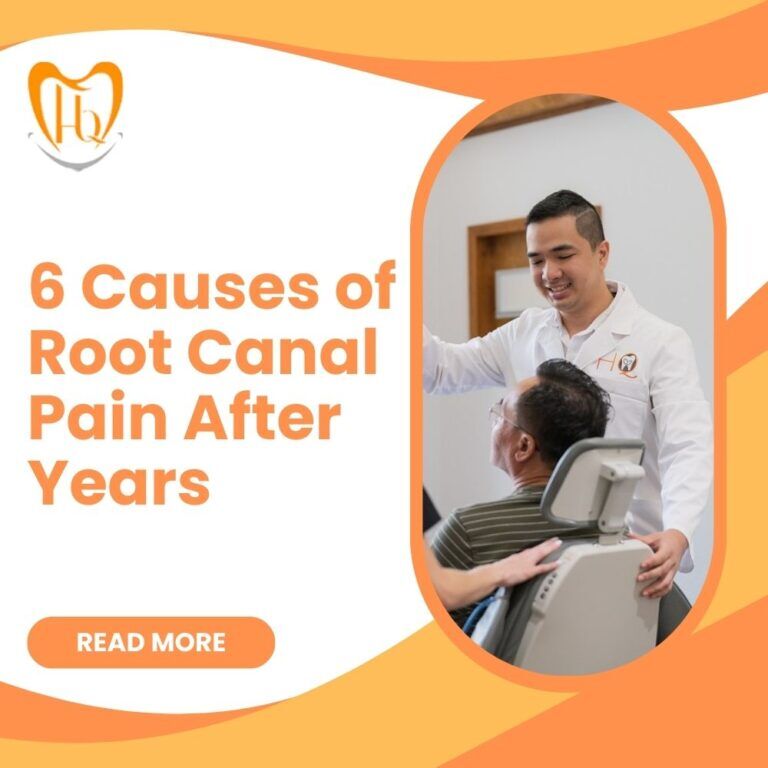 6 Shocking Causes of Root Canal Pain After Years