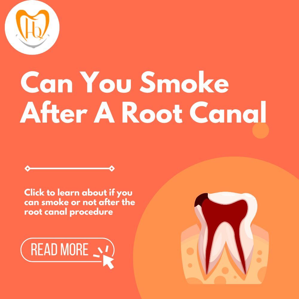Can You Smoke After a Root Canal? Easy Guide | 2026